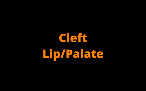 Cleft Lip/Palate by Ivy Hinson on Prezi