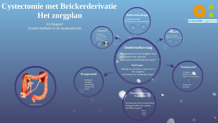 Cystectomie met Brickerderivatie by Iris Bogaert on Prezi