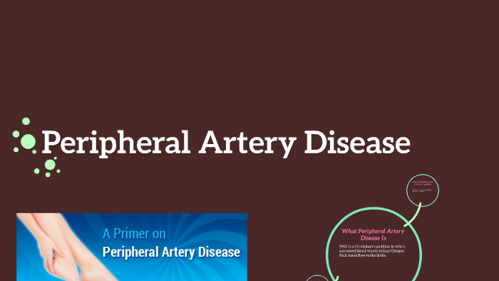 Peripheral Artery Disease by KRISTINA CHAFFEE on Prezi