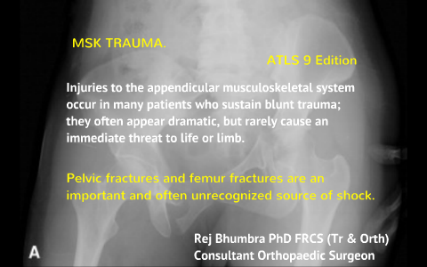 MSK TRAUMA ATLS 9th Ed by Rej Bhumbra on Prezi