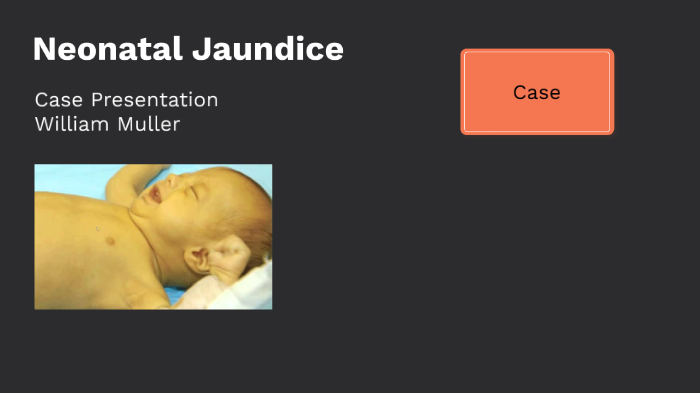 Neonatal Jaundice by William Muller on Prezi