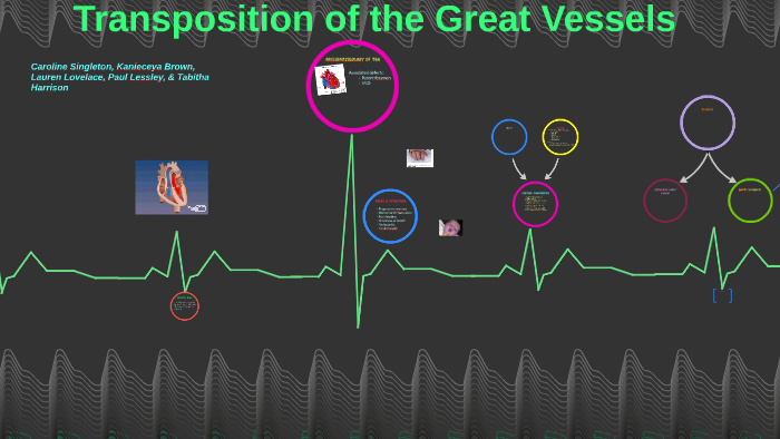 Transposition of the Great Vessels by Caroline Singleton on Prezi