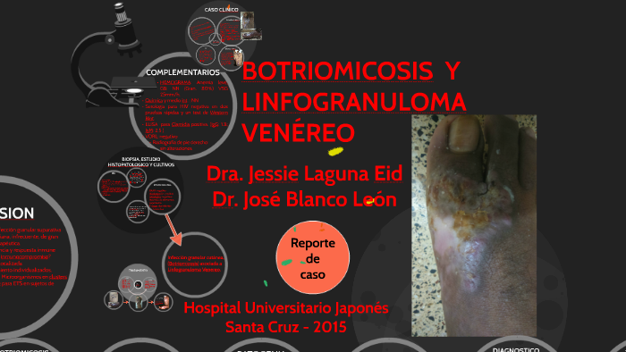 BOTRIOMICOSIS Y LINFOGRANULOMA VENÉREO by Jessie Laguna Eid on Prezi