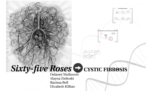 Sixty-five Roses by Delaney Mullennix on Prezi