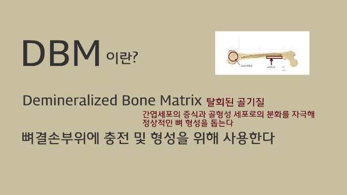 DBM by kim jinho on Prezi