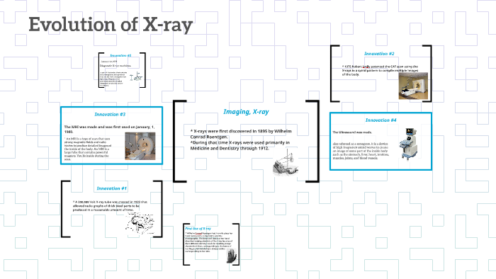 Evolution of X-ray by Jennifer Ramirez on Prezi