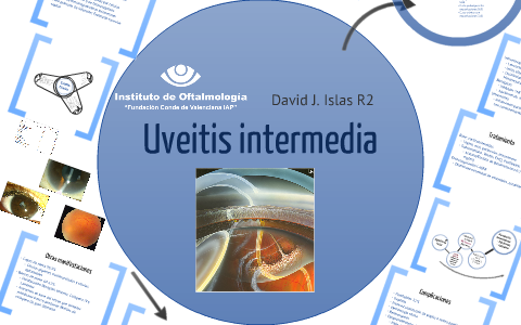 Uveitis intermedia by David Islas on Prezi