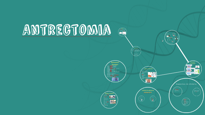 Antrectomia by Paulina Alva on Prezi