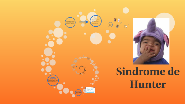 Sindrome de Hunter by Ale Cabello