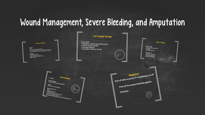 Wound Management, Severe Bleeding, and Amputation by Oscar Lau on Prezi