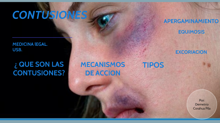 contuciones by carlos pils on Prezi