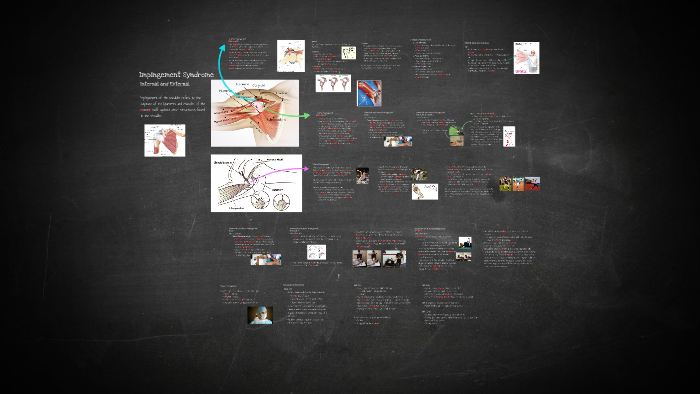 Impingement Syndrome by Kyle Headland on Prezi