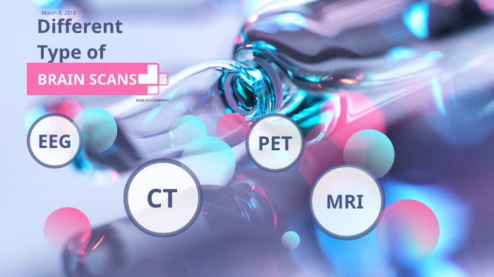 Different types of Brain Scans by Adamari Salinas on Prezi