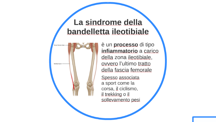 La sindrome della bandelletta ileotibiale by Marta Santo on Prezi