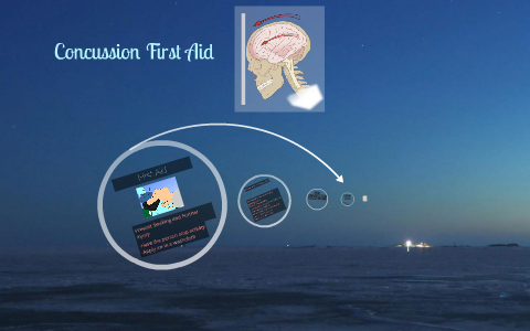 Concussion First Aid by Tye Mitchell