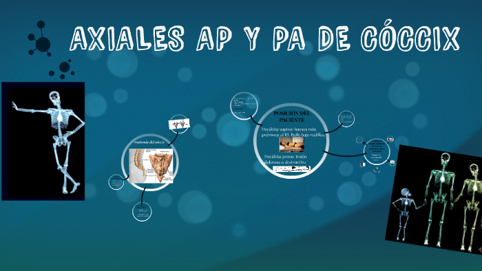 AXIALES AP Y PA DE CÓCCIX by Carolina Rodriguez Rodriguez on Prezi
