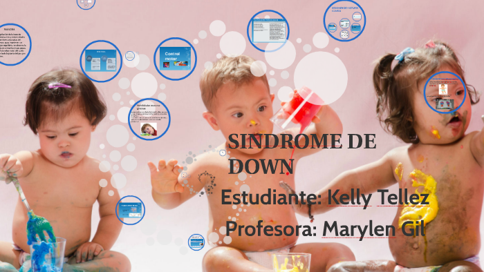 SINDROME DE DOWN by Kelly Tellez Tellez on Prezi