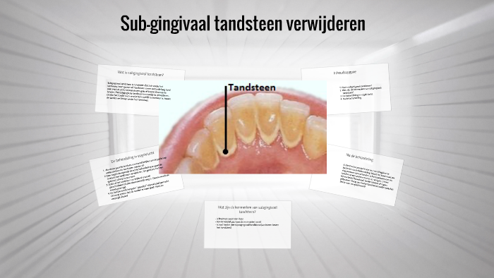 Sub gingivaal tandsteen verwijderen by Js Frh on Prezi