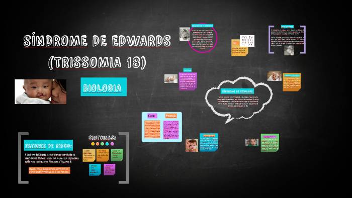 SÍNDROME DE EDWARDS (TRISSOMIA 18) by Joana Teles on Prezi
