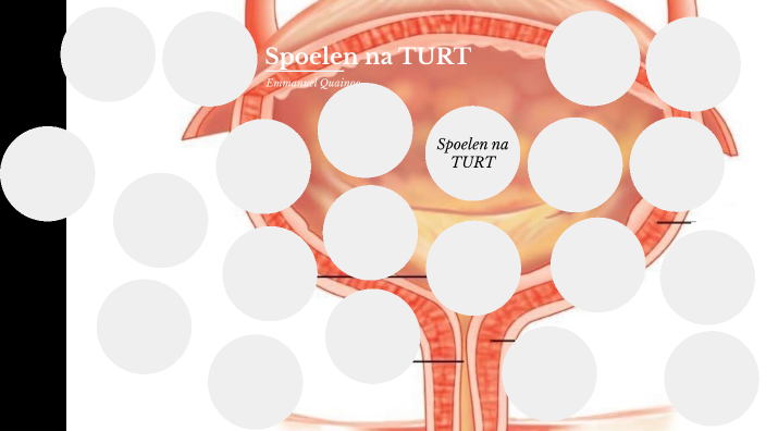 Spoelen na TURT by Emmanuel Quainoo on Prezi