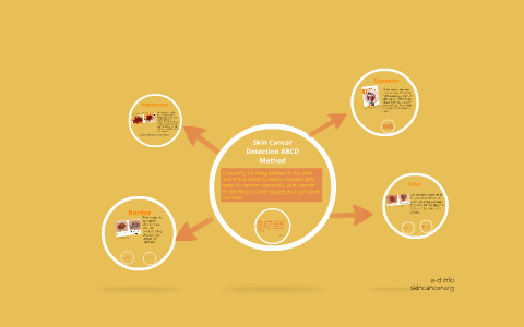 Skin Cancer Detection ABCD Method by Sheila Cabello on Prezi