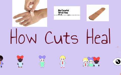 How Cuts Heal by Opal Close on Prezi
