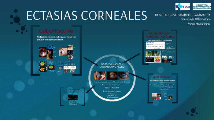 Ectasias Corneales By Mireia Molina On Prezi