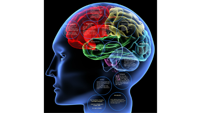 The Teen Brain: Insights from Neuroimaging by Megan Hanes