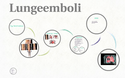 Lungeemboli by Synne Diesen on Prezi