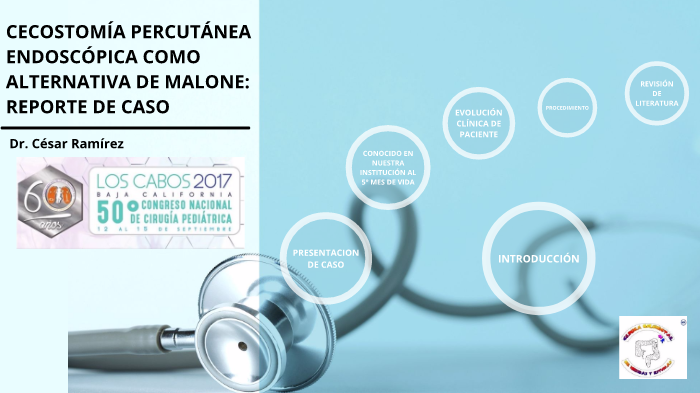 CECOSTOMÍA PERCUTÁNEA ENDOSCÓPICA by CESAR RAMIREZ on Prezi
