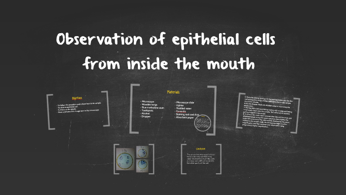 Observation of epithelial cells by on Prezi