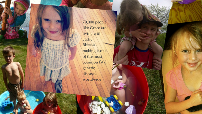 Team Amazing Grace 2016, Walk to make Cystic Fibrosis HISTORY by Jamie Voss