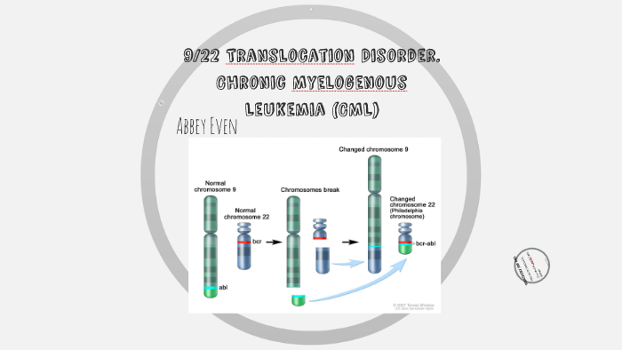 9/22 Translocation Disorder by Abbey Even on Prezi