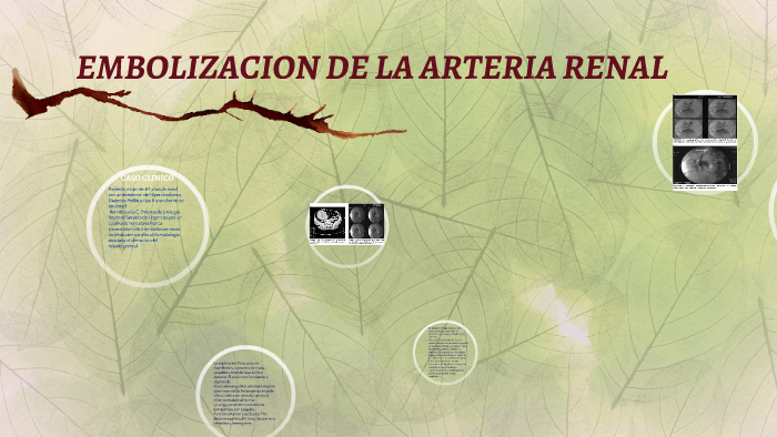 EMBOLIZACION DE LA ARTERIA RENAL by Rosa Ramirez Zurita on Prezi