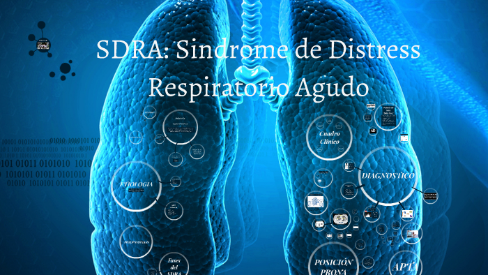 SDRA: Sindrome de Distress Respiratorio Agudo by Andres Zuñiga on Prezi