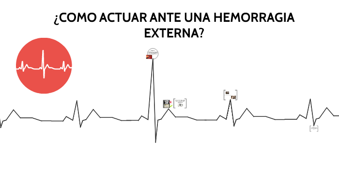¿COMO ACTUAR ANTE UNA HEMORRAGIA EXTERNA? by FRANCISCA LOPEZ GEA on Prezi