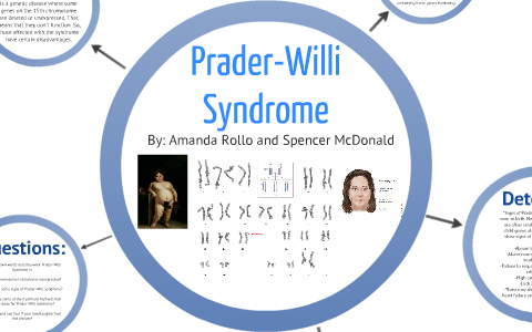 Parenting Project: Prader-Willi Syndrome by amanda rollo on Prezi