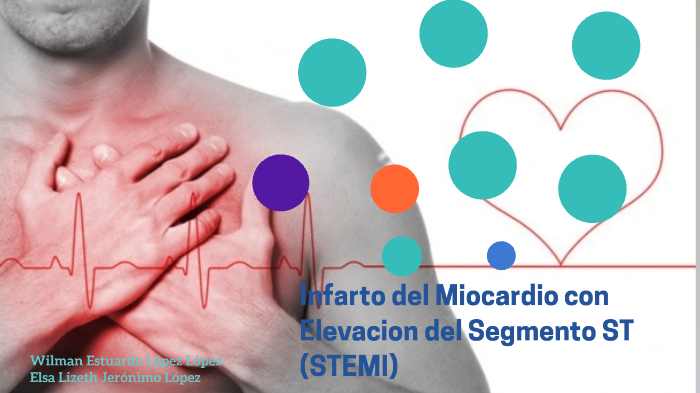 Infarto Agudo del Miocardio con Elevación del Segmento ST by lizeth ...
