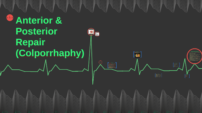Anterior/Posterior Repair by Natalie Wong on Prezi