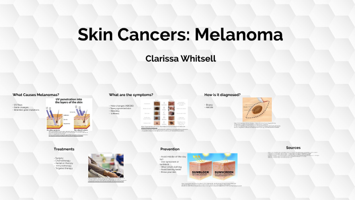 Skin Cancer Melanoma By On Prezi