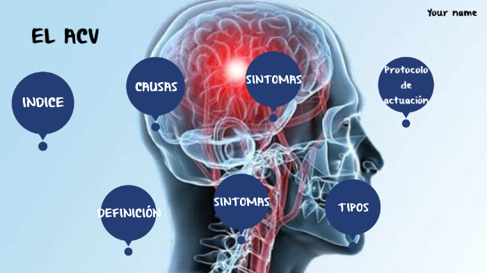 EL ACV (ACCIDENTE CEREBRO VASCULAR) by María Gutiérrez Sánchez on Prezi