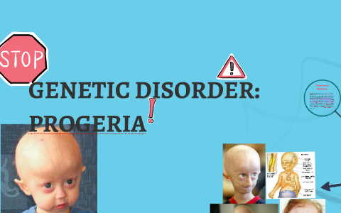 GENETIC DISORDER: PROGERIA by Stella Lim on Prezi