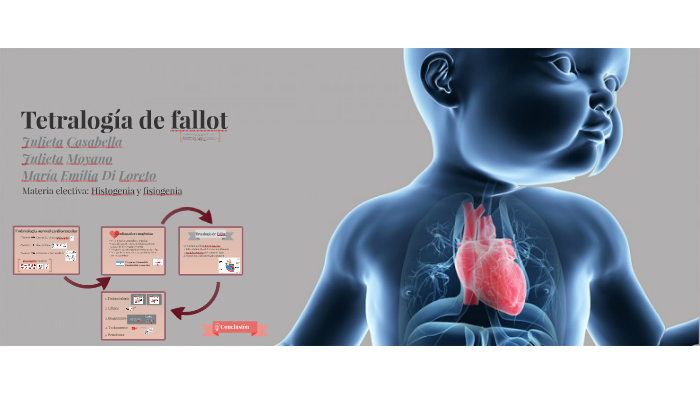 Tetralogía de fallot by emilia dilo on Prezi