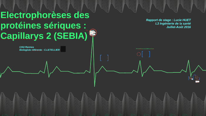Electrophorèses des protéines sériques : Capillarys 2 (SEBIA by Lucie ...