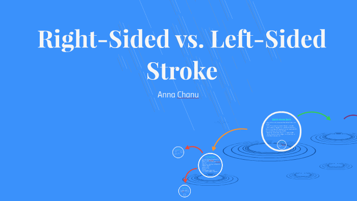 The Difference Between Left Sided and Right Sided Stroke by Anna Chanu ...