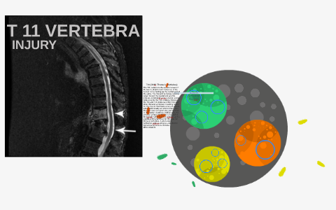 T 11 VERTEBRA by Lesette Pate on Prezi