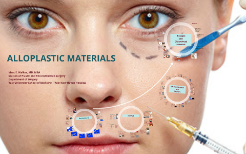 Alloplastic Materials: by Marc Walker on Prezi