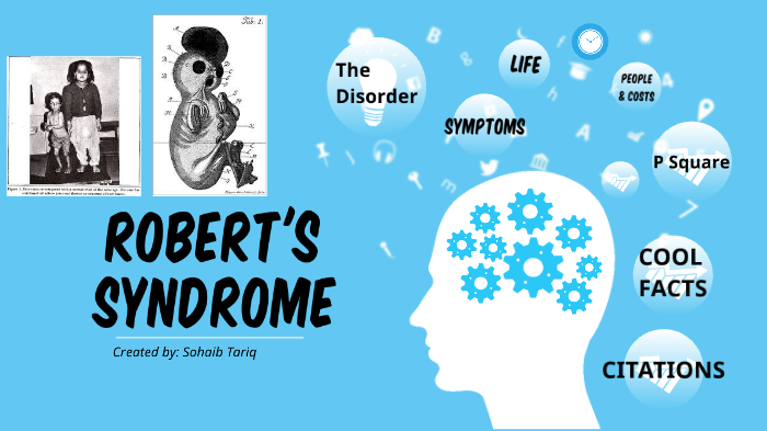 Robert's Syndrome by Sohaib Tariq on Prezi