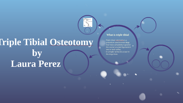 Triple Tibial Osteotomy by Laura Perez on Prezi