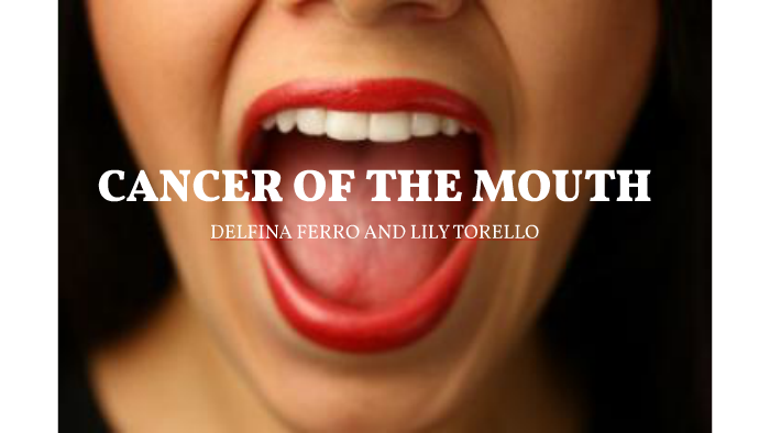 CANCER OF THE MOUTH by Peter Torello on Prezi